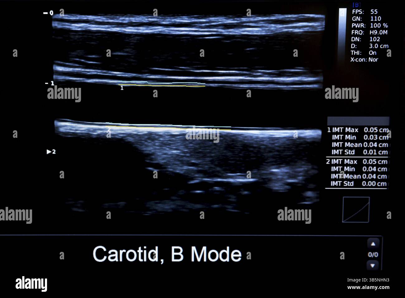 Colourful image of modern ultrasound monitor. Ultrasonography machine ...
