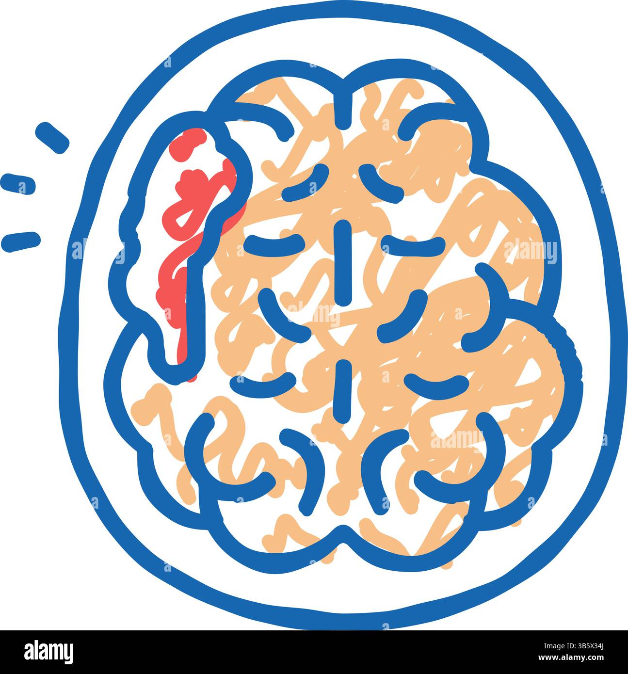 Brain stroke icon doodle Stock Vector Images - Alamy
