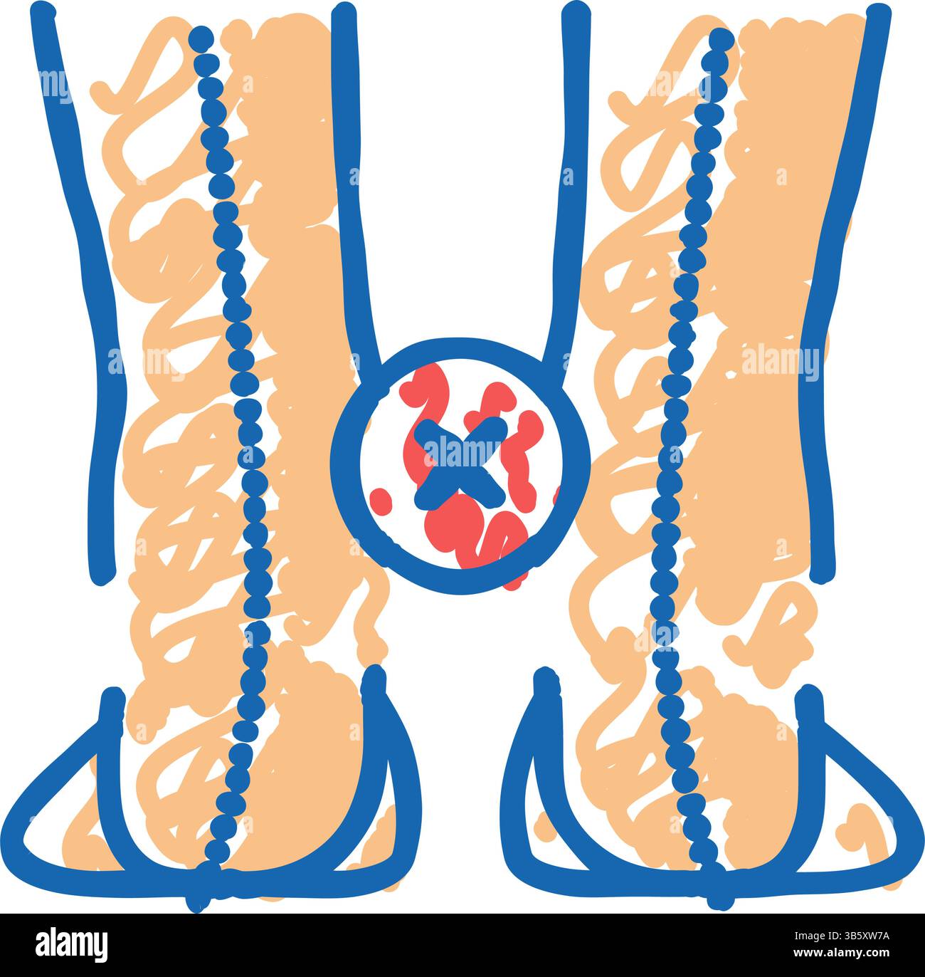 curvature of legs inward icon doodle illustration Stock Vector Image ...