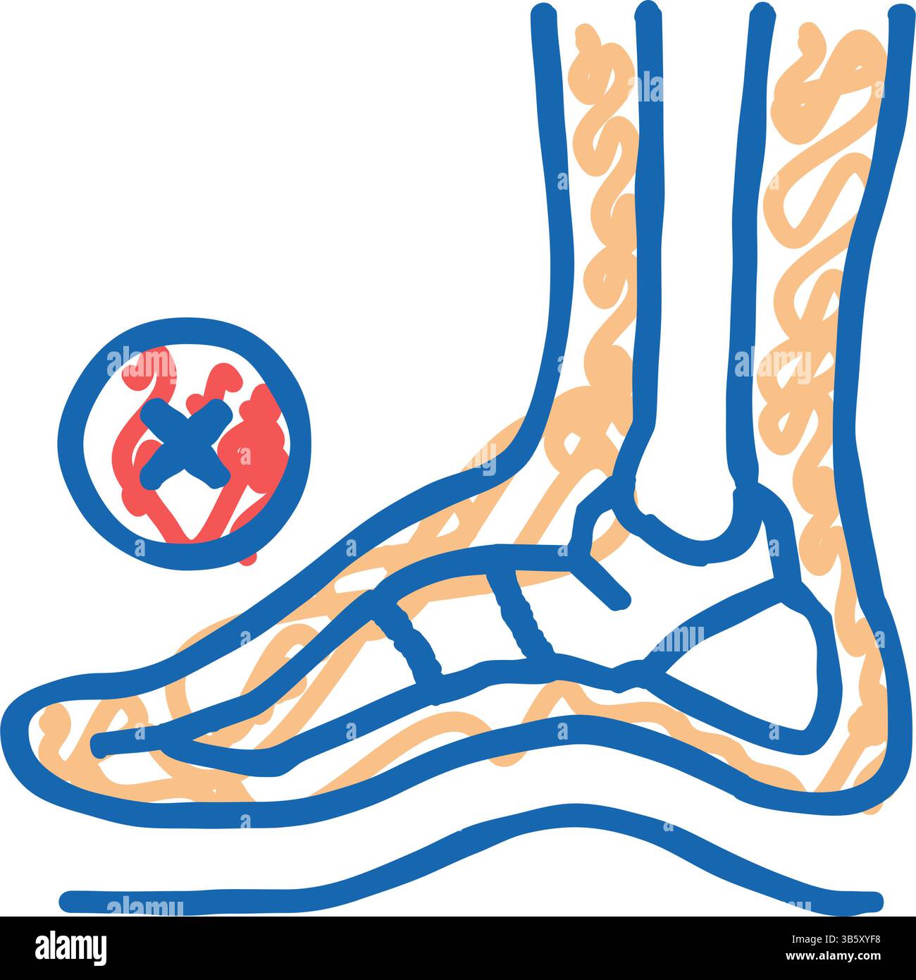 bone postural deformity feet icon doodle illustration Stock Vector ...