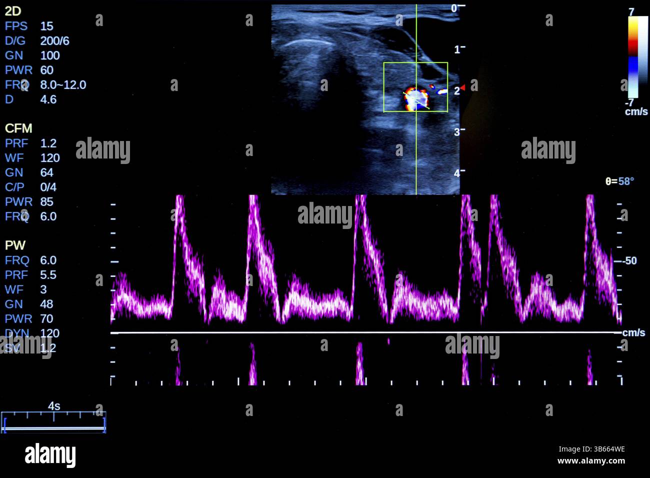 Colourful image of modern ultrasound monitor. Ultrasonography machine ...