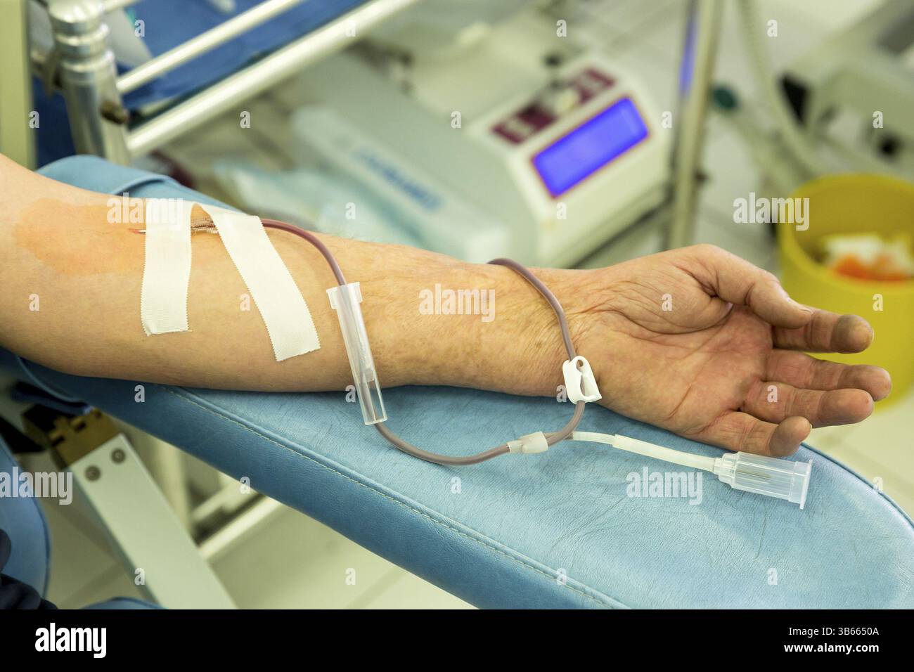 The hand of a blood donor during the process of donating blood in a ...