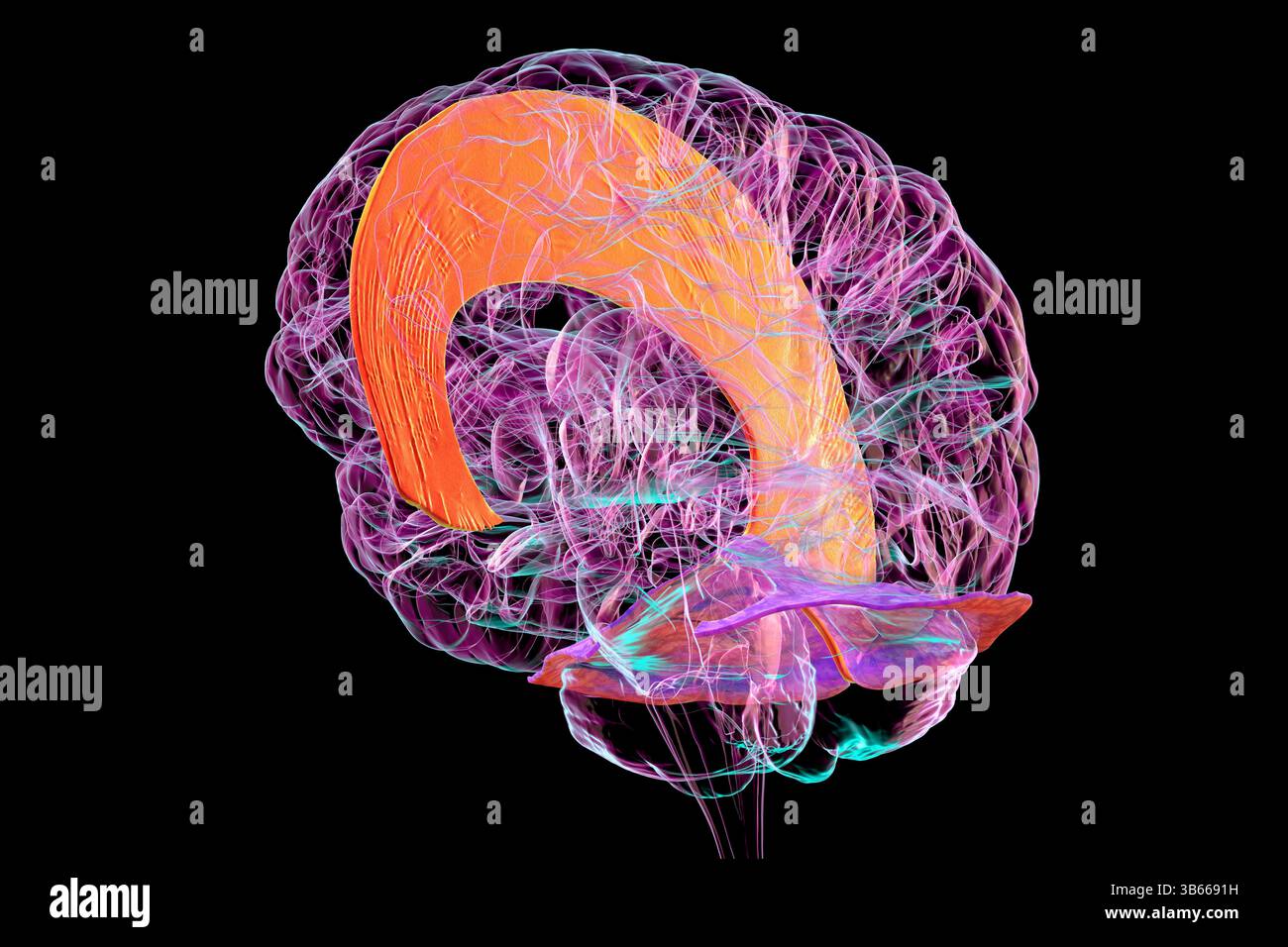 Illustration of a human brain with highlighted falx cerebri (orange ...