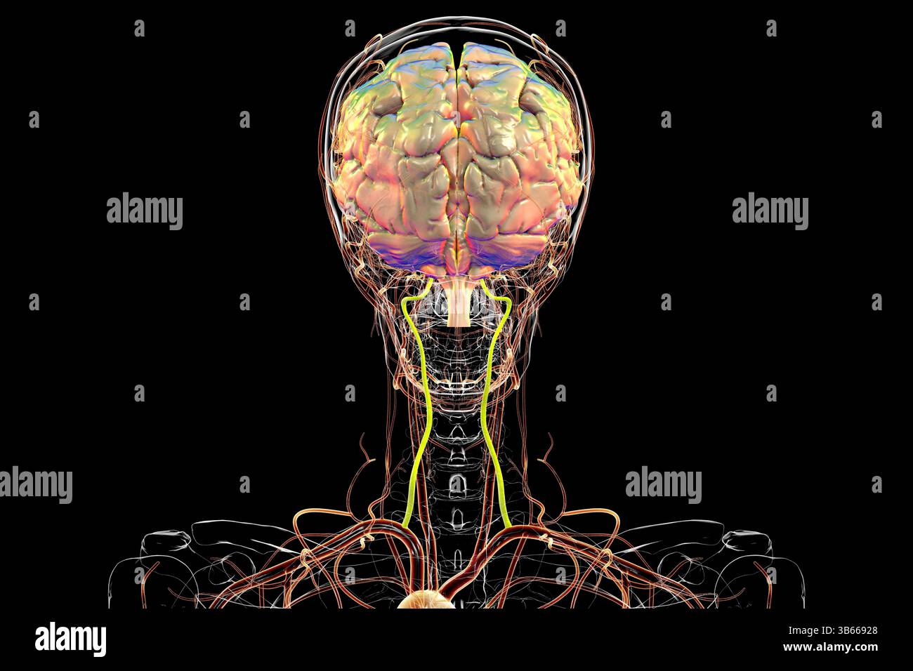 Illustration of the vertebral arteries (yellow), supplying blood to the ...