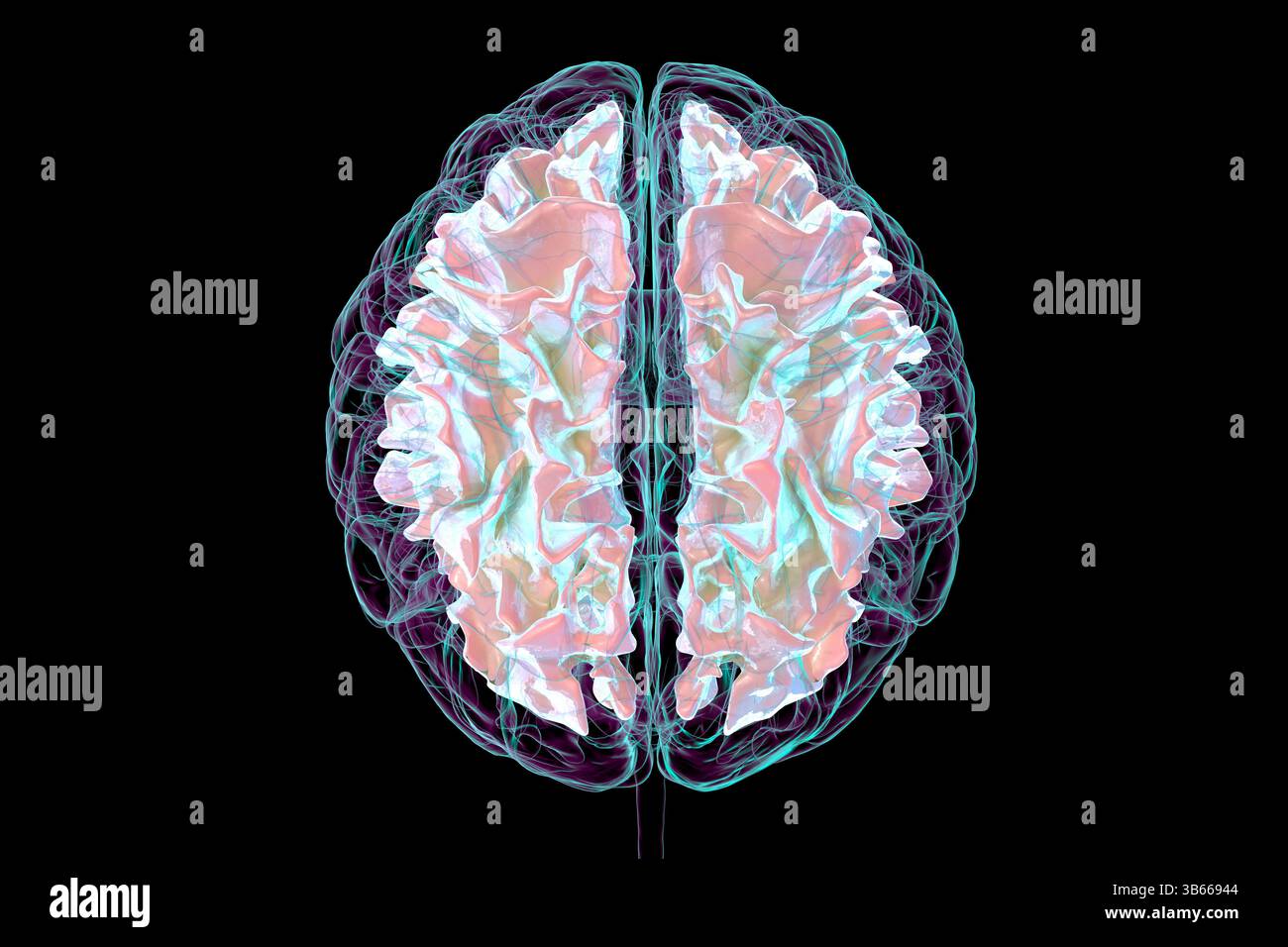Illustration of a human brain with highlighted white matter. White ...