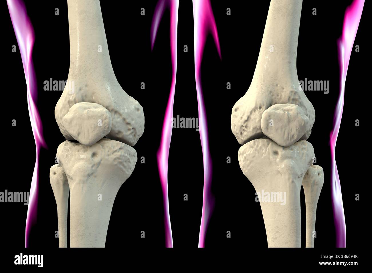 Tibia and fibula hi-res stock photography and images - Alamy