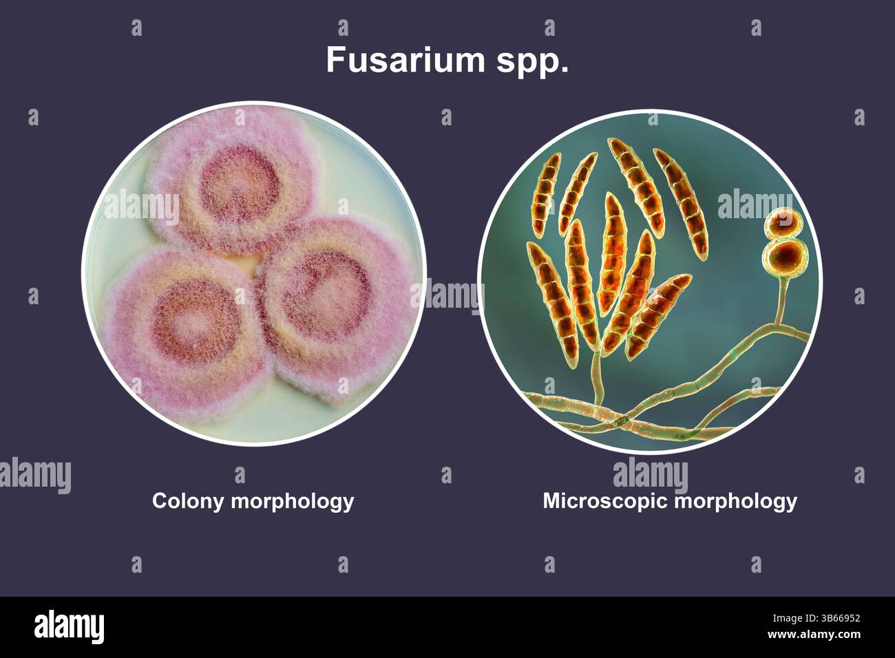 Illustration of Fusarium sp. fungi, showing the microscopic structure ...