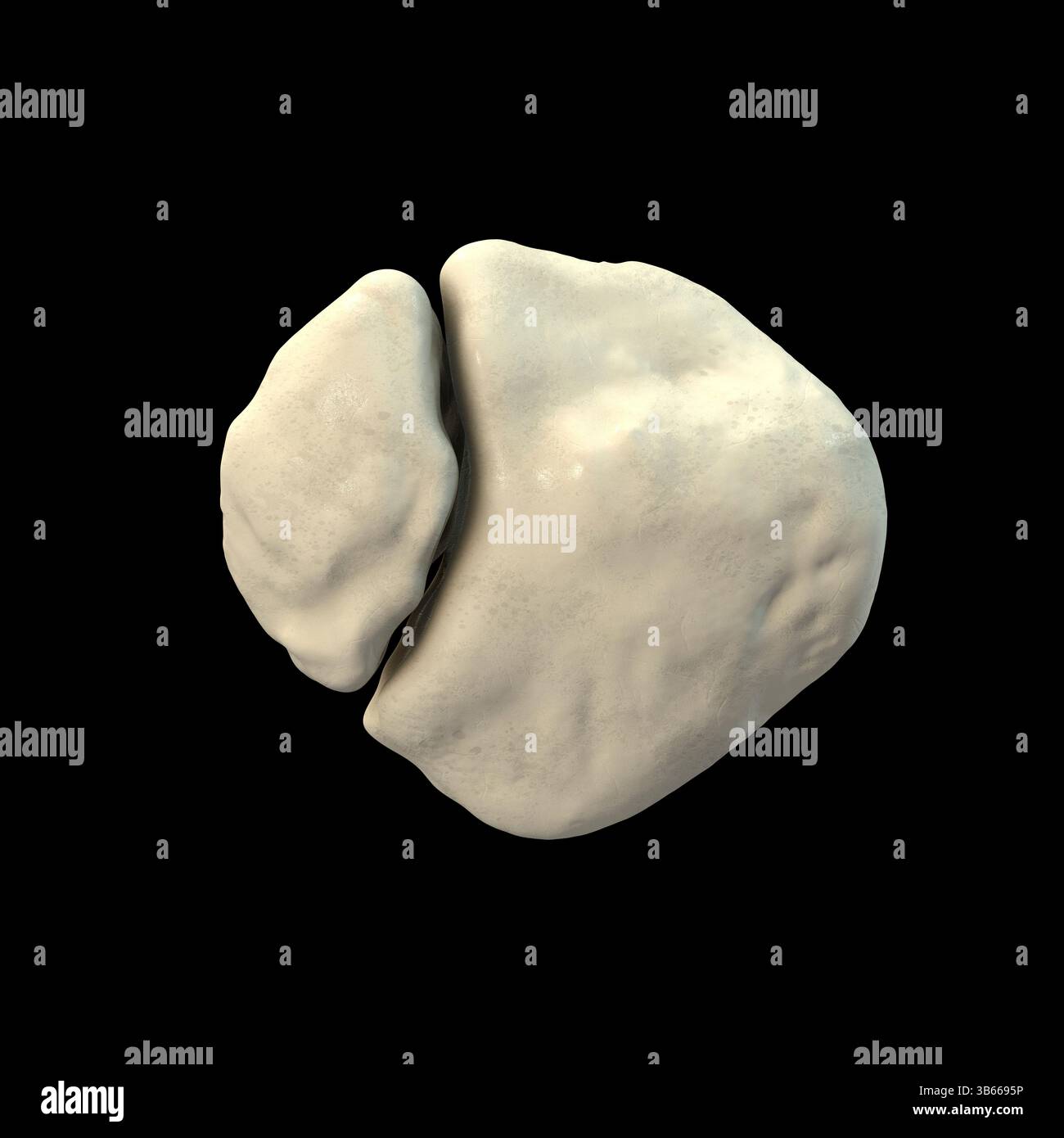 Illustration of a bipartite patella. This a condition where the kneecap ...