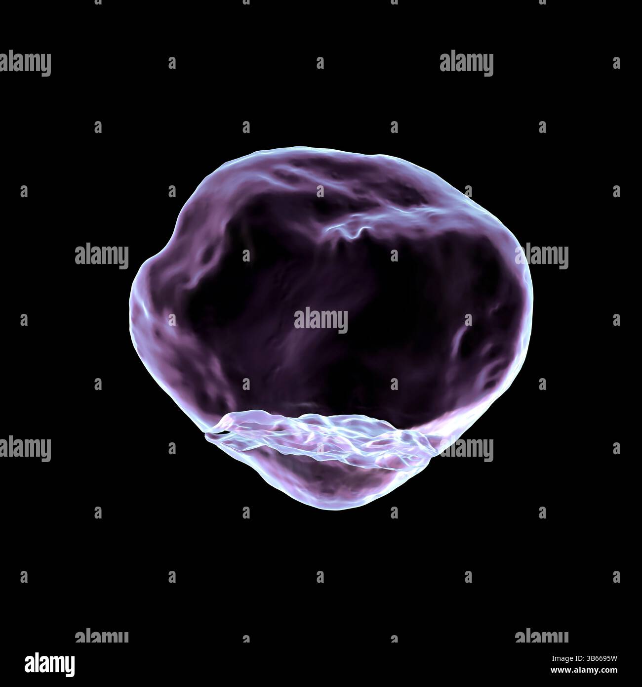 Illustration of a patella lower pole fracture, showing a break at the ...