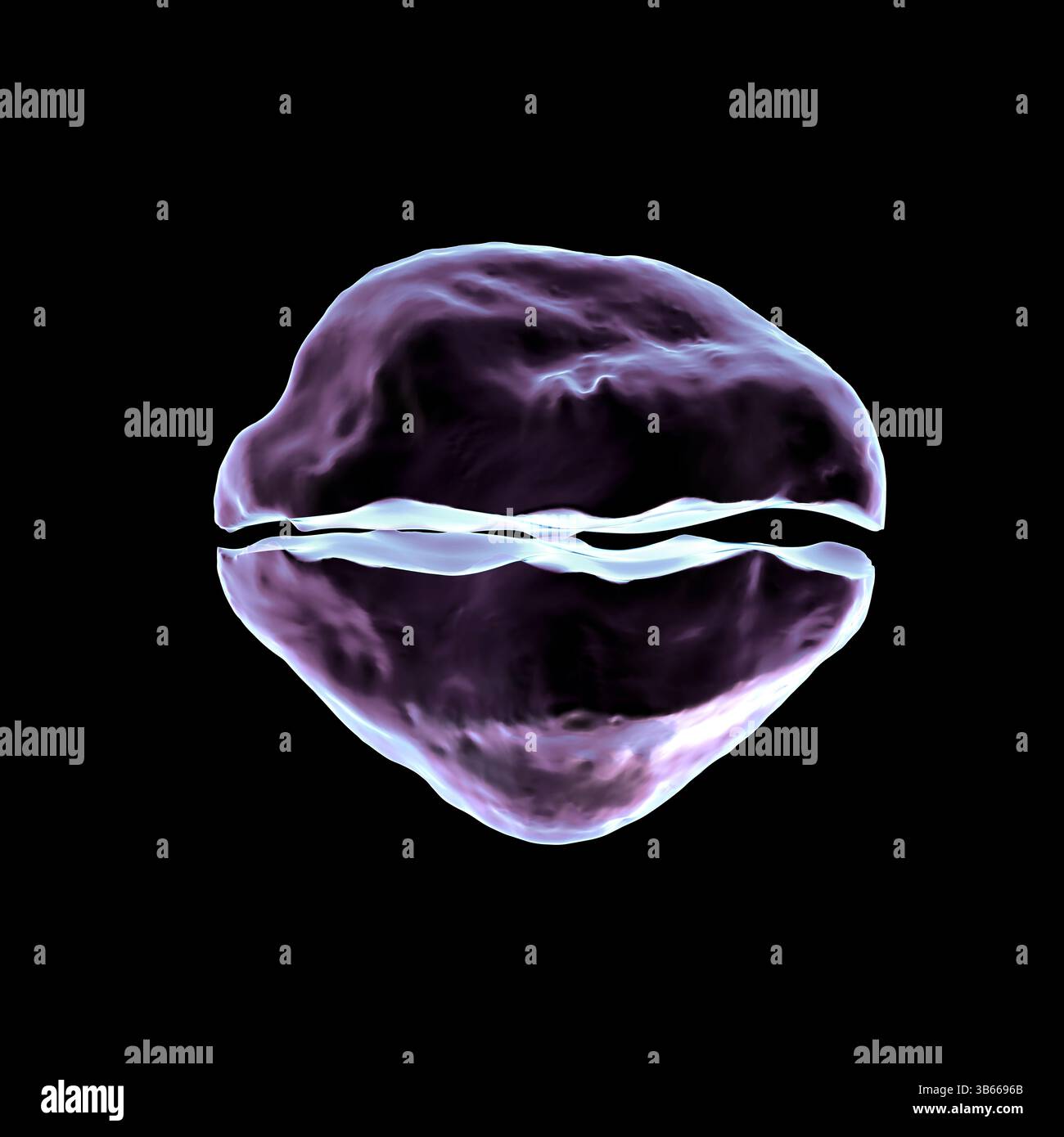 Illustration of a patella transverse displaced fracture, showing a ...