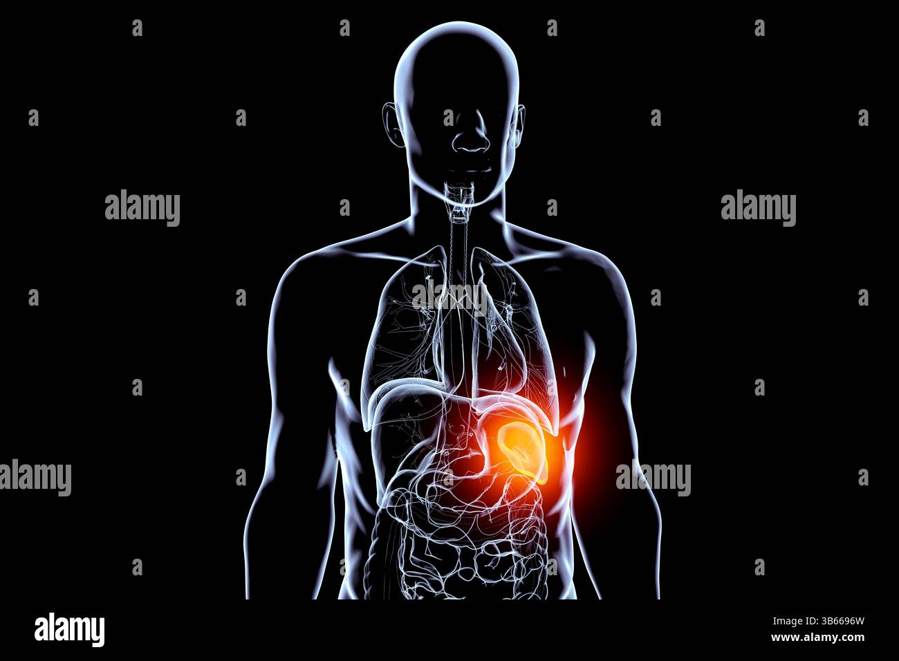 Illustration of the human body anatomy with highlighted spleen. The ...