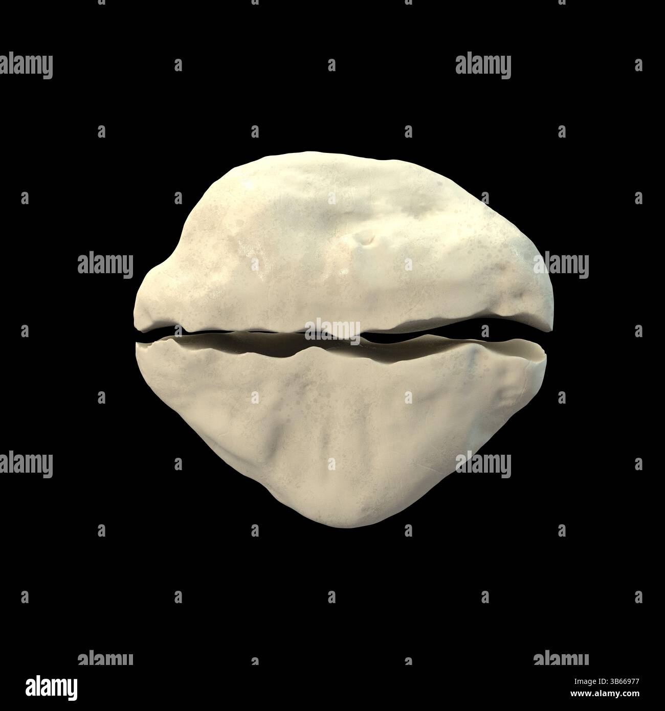 Illustration of a patella transverse displaced fracture, showing a ...