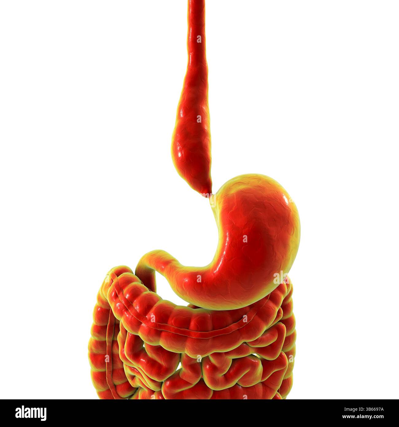 Illustration of megaoesophagus, a condition where the oesophagus ...