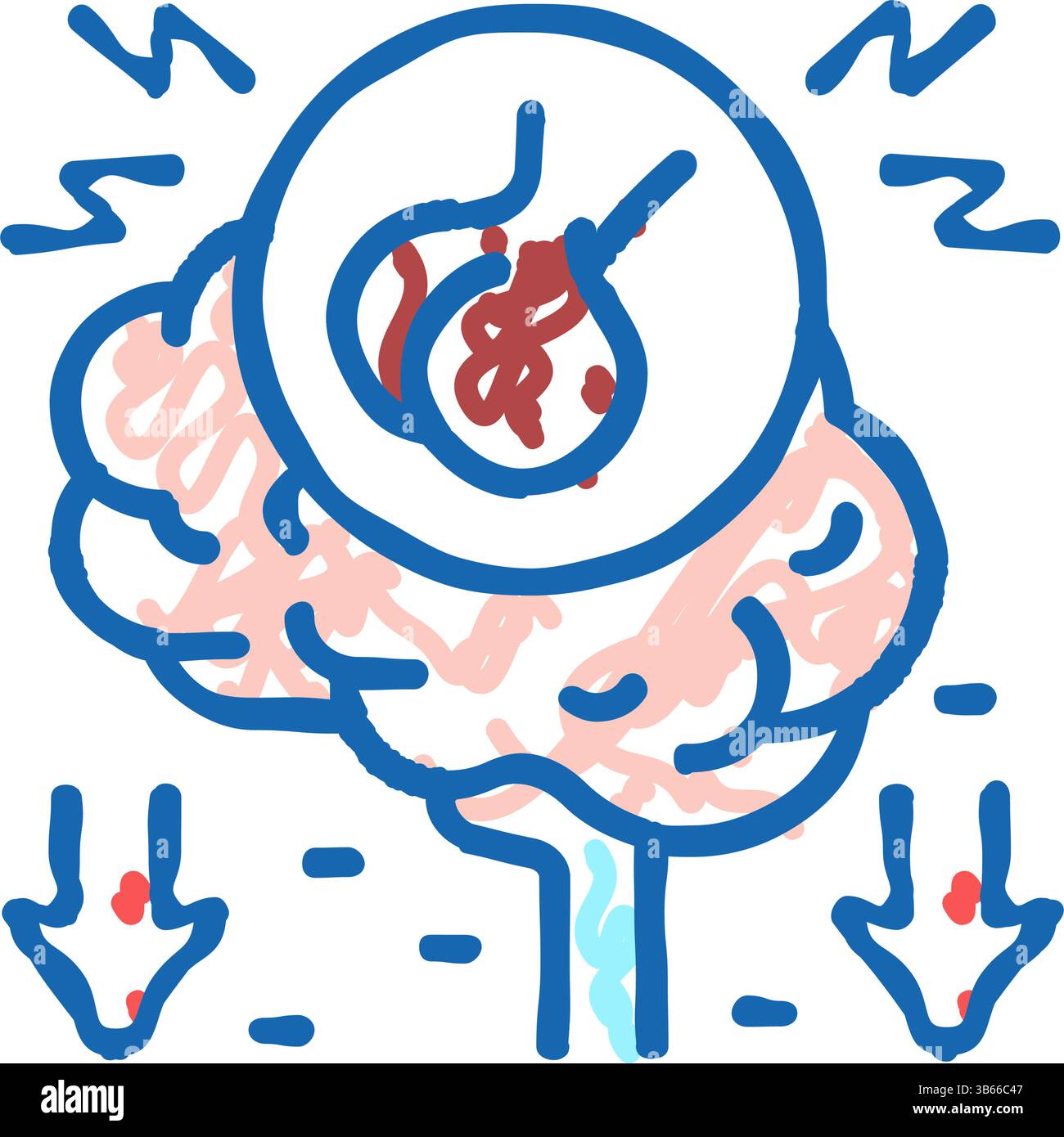 hypopituitarism endocrinology icon doodle illustration Stock Vector ...