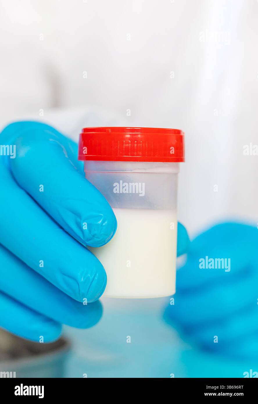 Milk plasma hi-res stock photography and images - Alamy