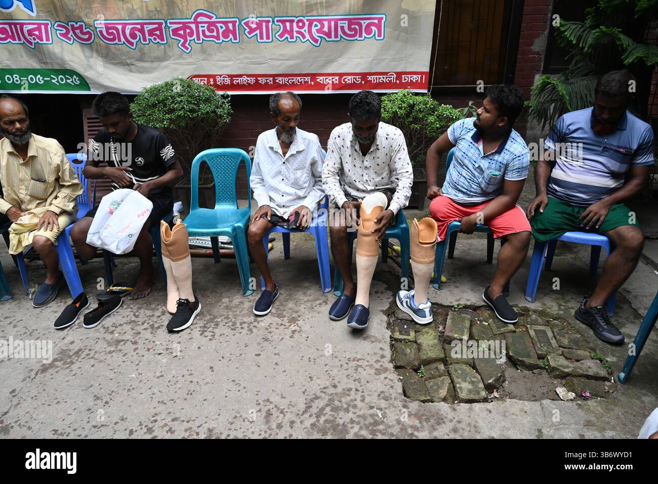 People with their artificial Prosthetic legs fitted during artificial ...