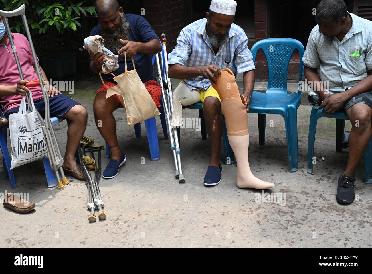 People with their artificial Prosthetic legs fitted during artificial ...