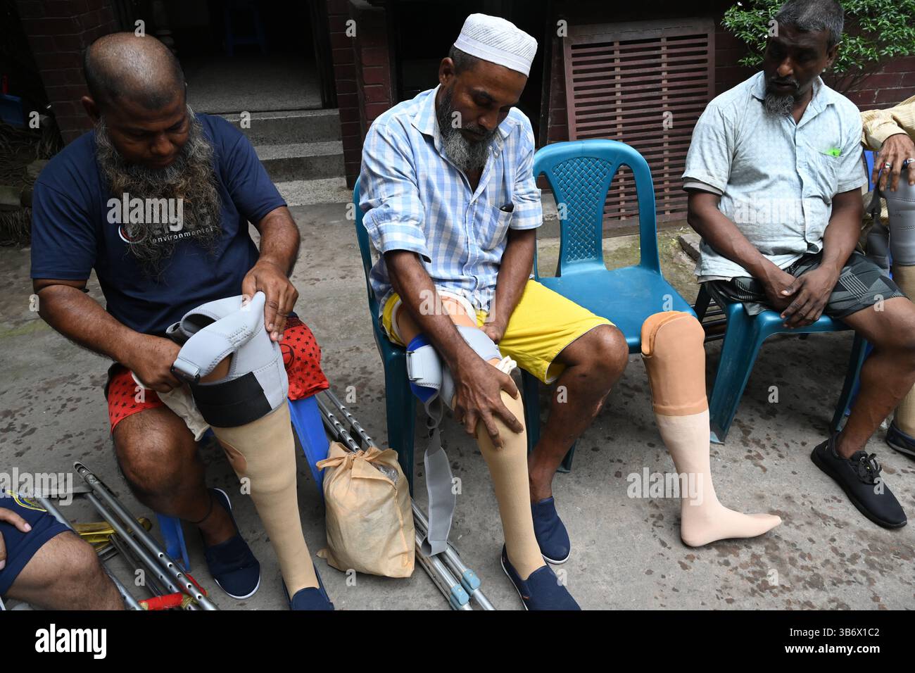People with their artificial Prosthetic legs fitted during artificial ...