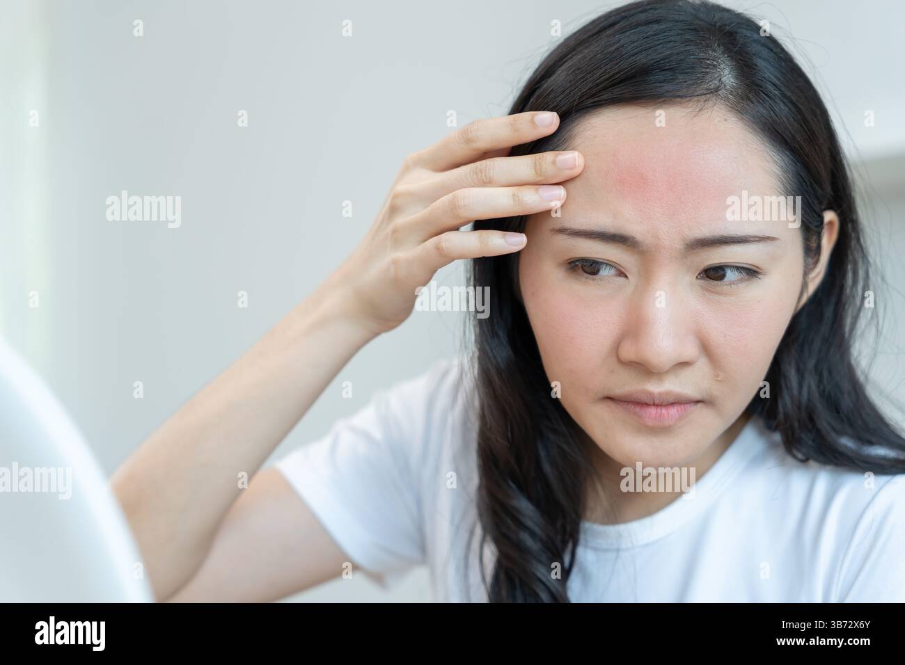 Woman worried about face Dermatology; rosacea dermatitis; allergic ...