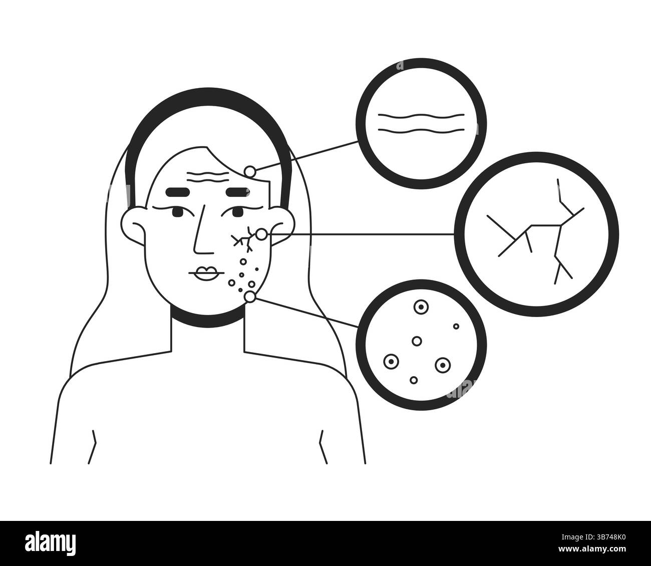 Blonde woman skin problems face diagram line illustration concept Stock ...