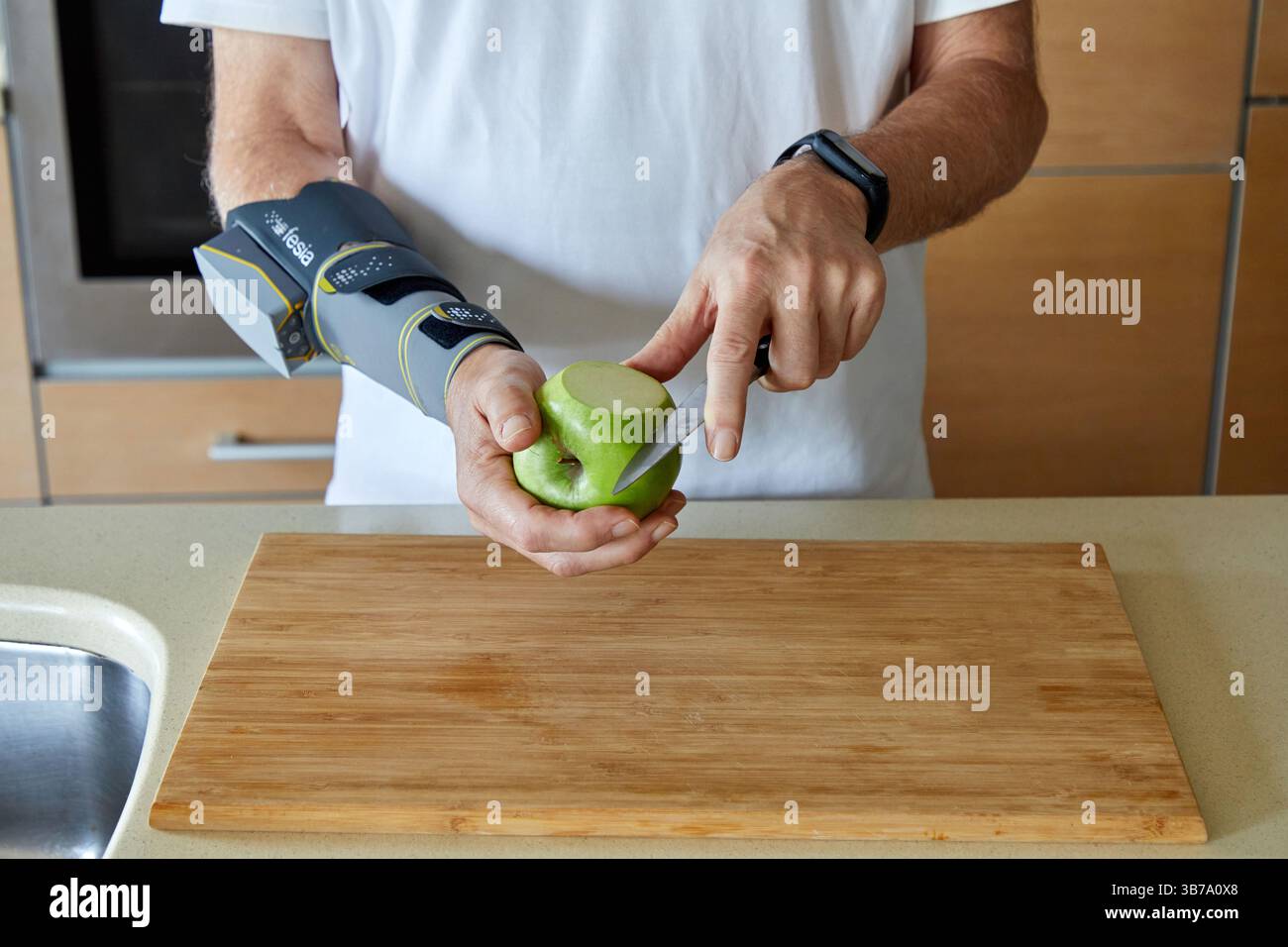 The rehabilitation device based on functional electrical stimulation ...