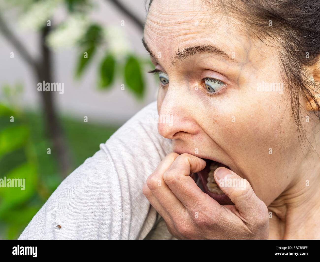 A closeup of a deer tick found crawling around on the arm of a person ...