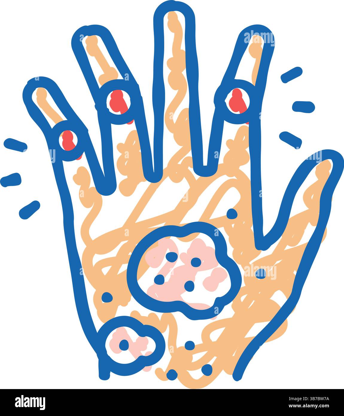 psoriatic arthritis skin health problem icon doodle illustration Stock ...