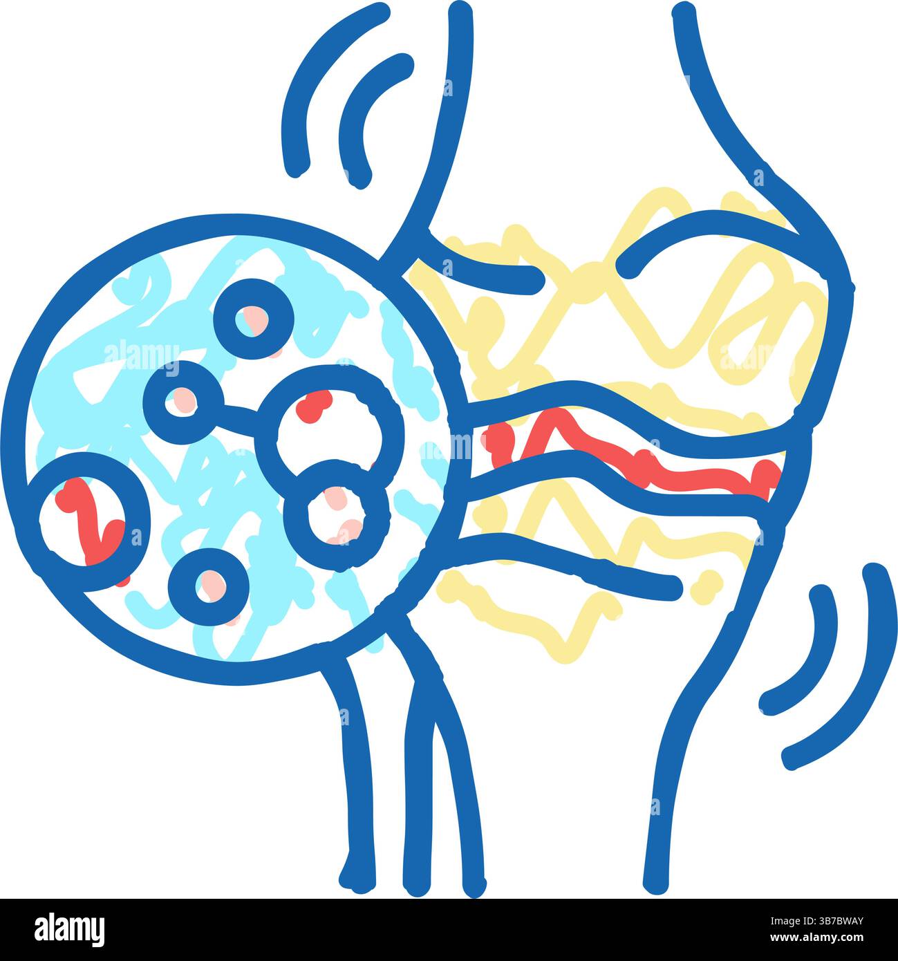 juvenile idiopathic arthritis icon doodle illustration Stock Vector ...