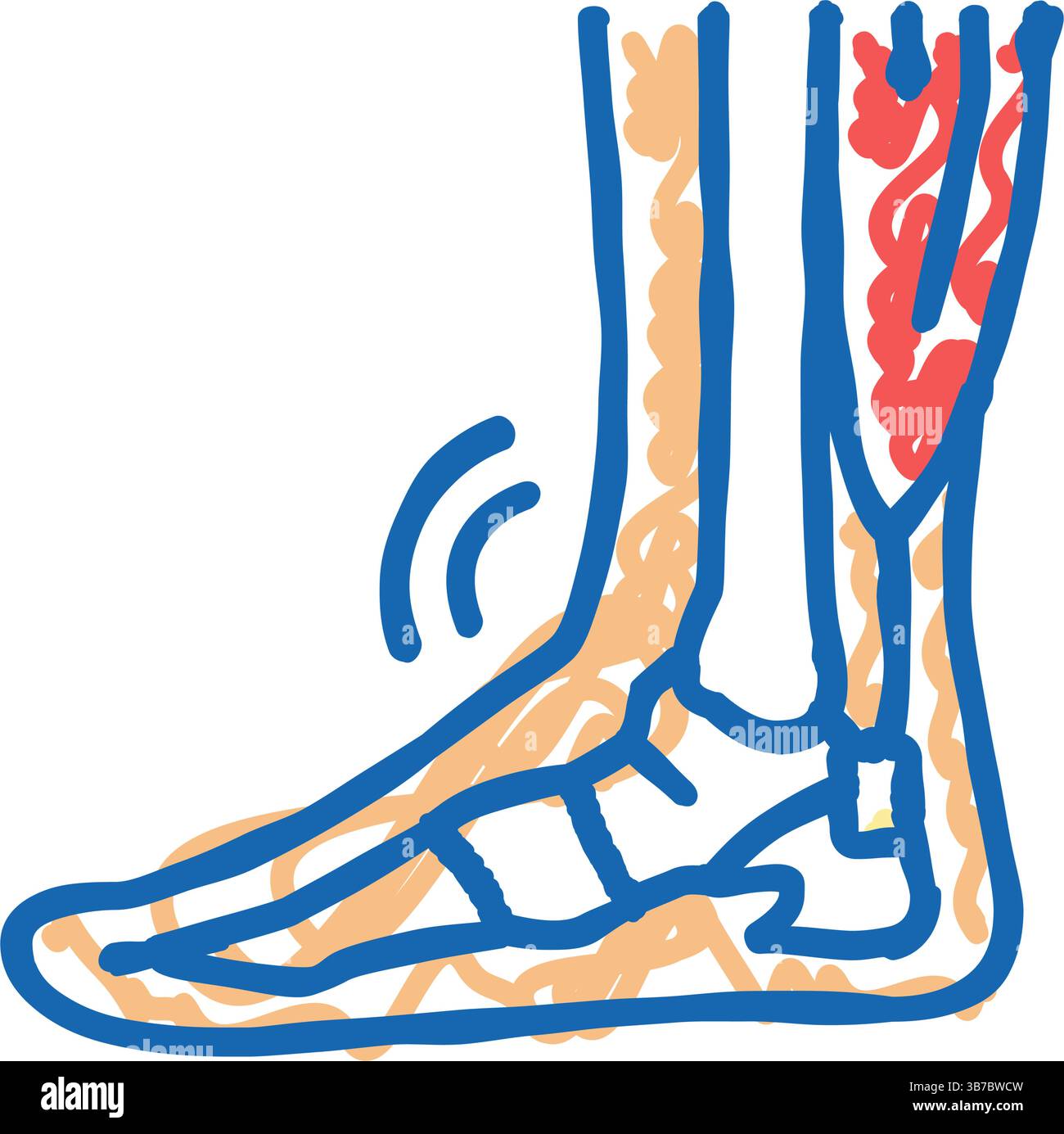 tendonitis problem icon doodle illustration Stock Vector Image & Art ...