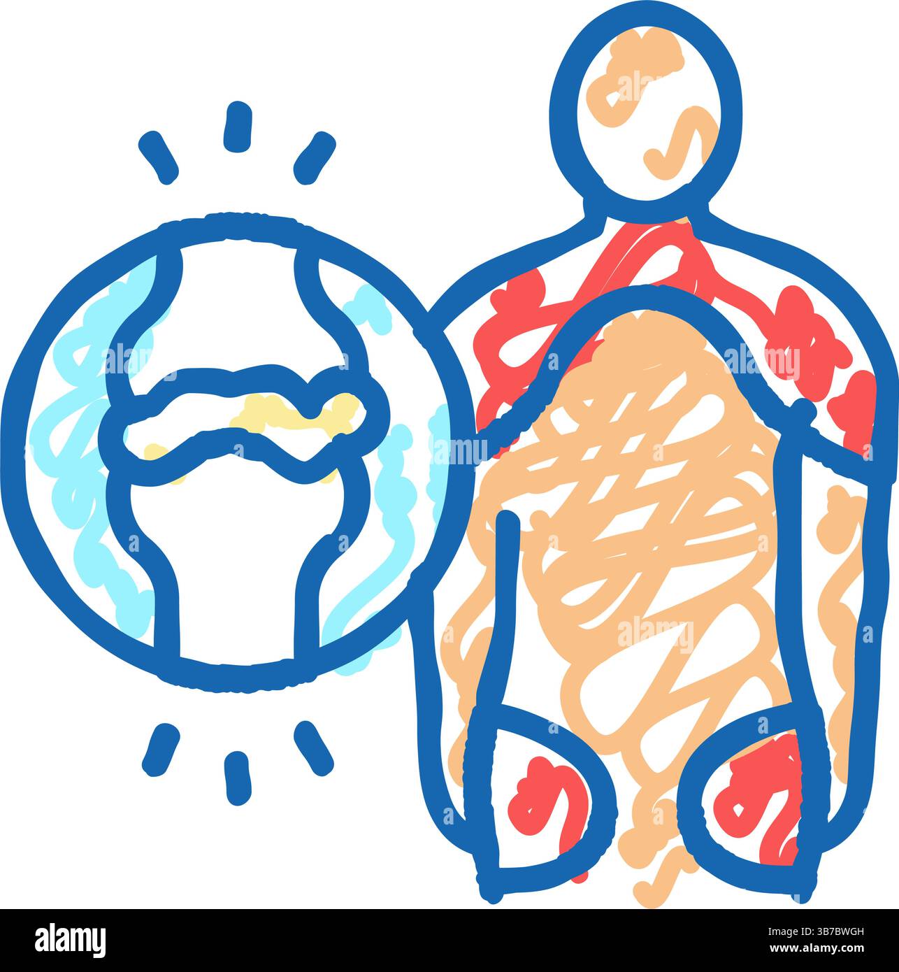 polymyalgia rheumatica icon doodle illustration Stock Vector Image ...