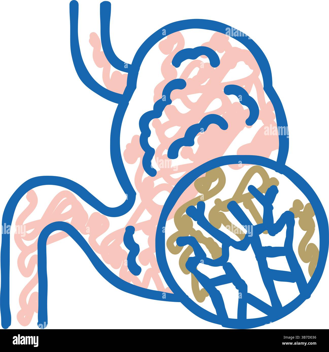 abdominal swelling mesothelioma icon doodle illustration Stock Vector ...