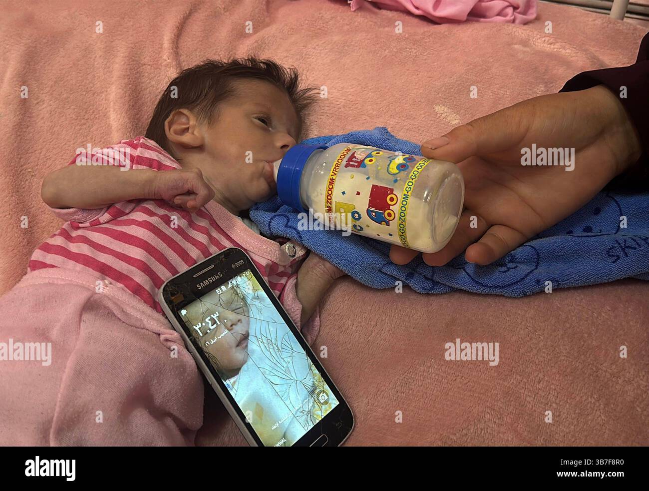 The Palestinian infant, Youssef Al-Najjar, four months old, is ...