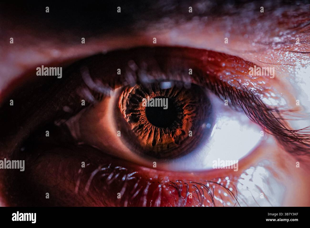 Solar retinopathy hi-res stock photography and images - Alamy