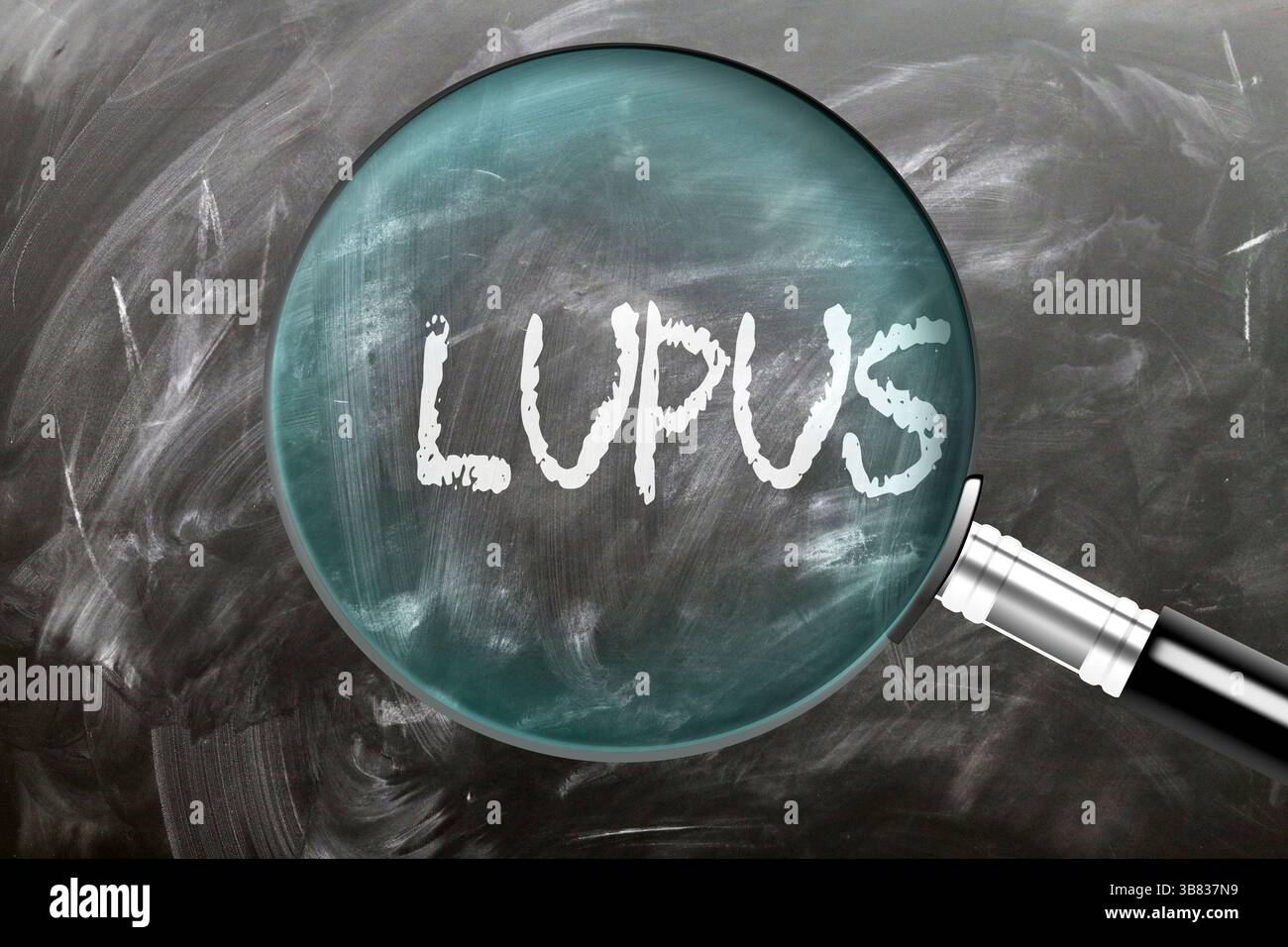Lupus learn hi-res stock photography and images - Alamy