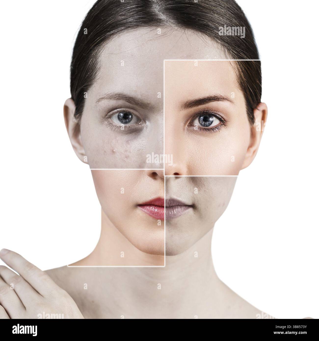 Collage parts of woman's face before and after treatment and makeup ...