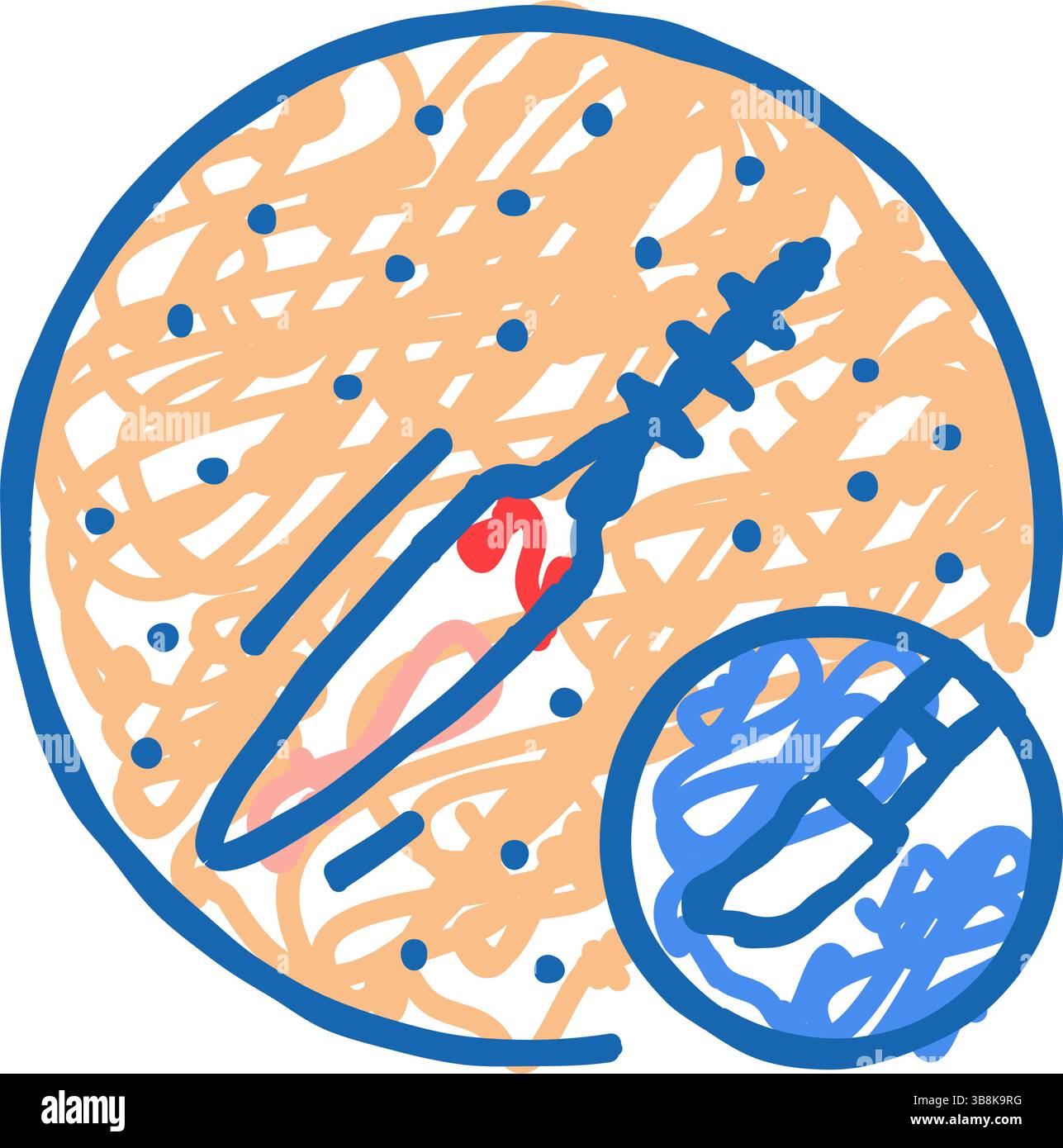 hysterectomy surgery doctor icon doodle illustration Stock Vector Image ...