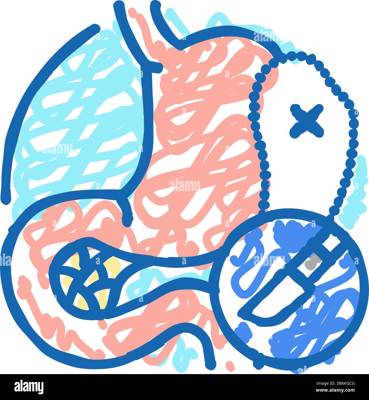 splenectomy surgery hospital icon doodle illustration Stock Vector ...