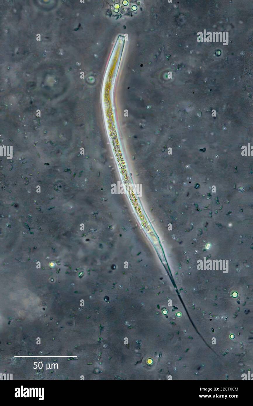 A roundworm (Phylum Nematoda) collected from a fresh water culture ...