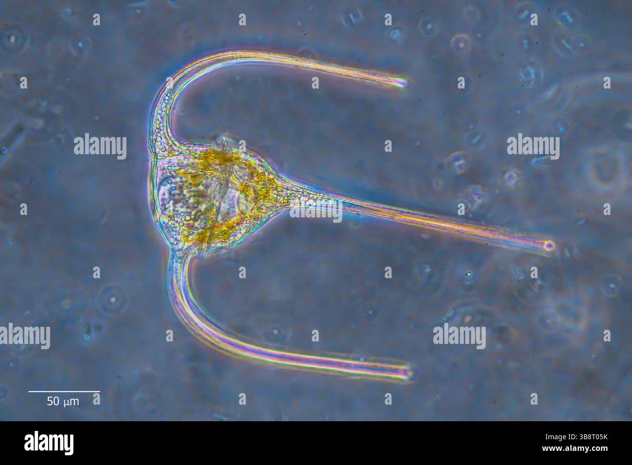 Marine dinoflagellate from genus Tripos (probably T. horridus, syn ...