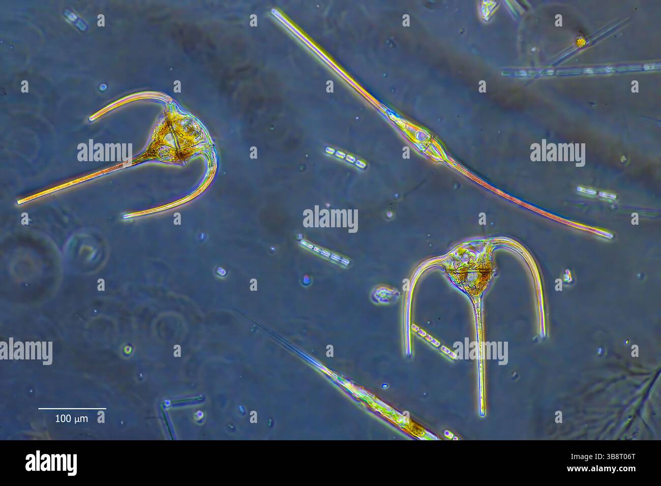 Marine dinoflagellates from genus Tripos (syn: Ceratium), probably T ...