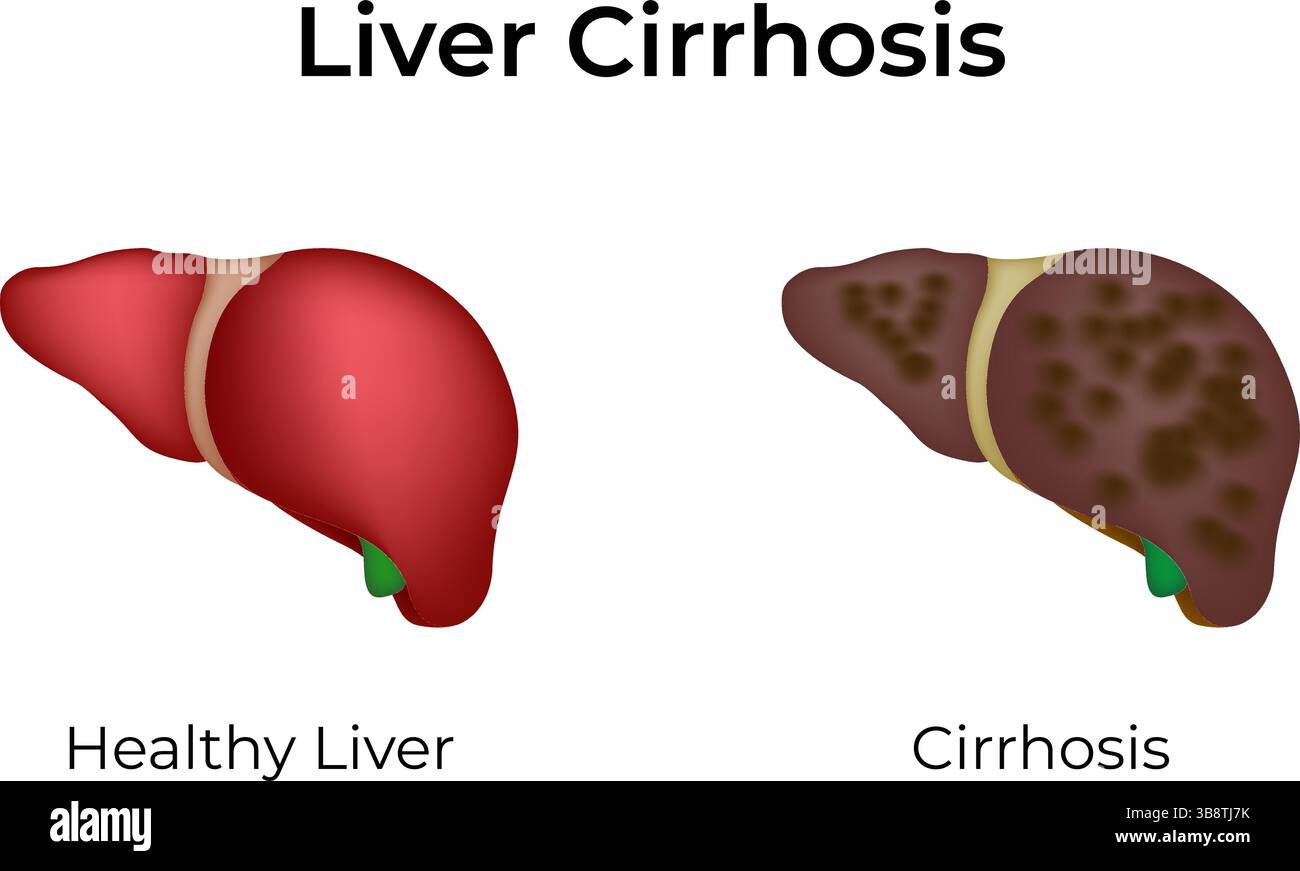 Liver human cartoon design Stock Vector Images - Alamy