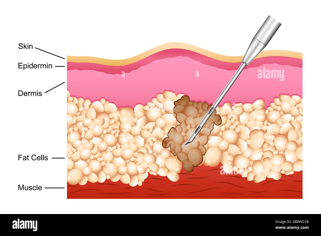 illustration of educational cutout diagram of human skin showing the ...