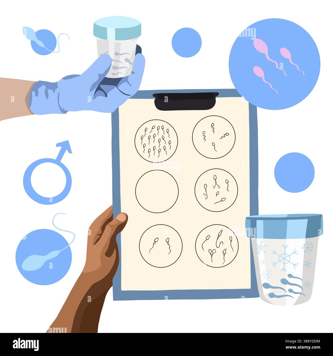 Vector isolated illustration of sperm defects. Spermogram. Laboratory ...