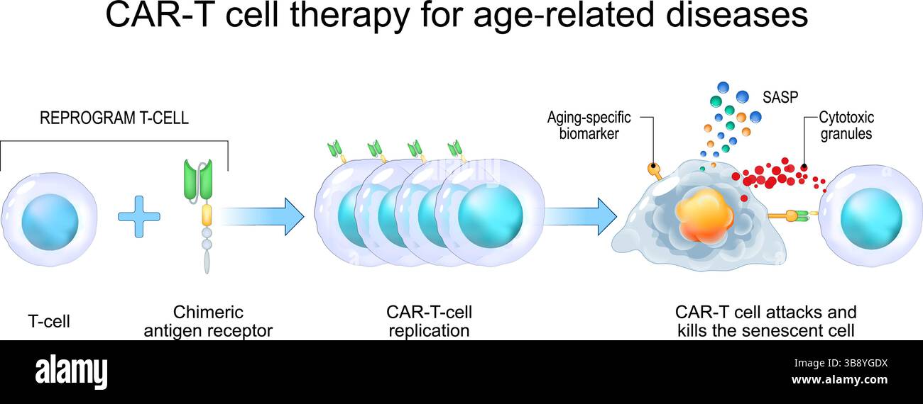 Car t cell leukemia Cut Out Stock Images & Pictures - Alamy