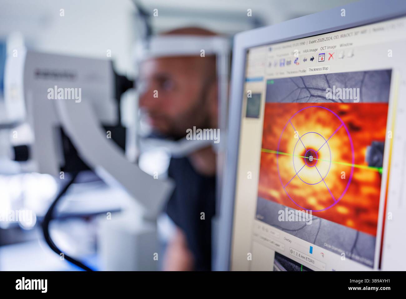Erlangen, Germany. 23rd May, 2024. An OCT angiography of the fundus of ...