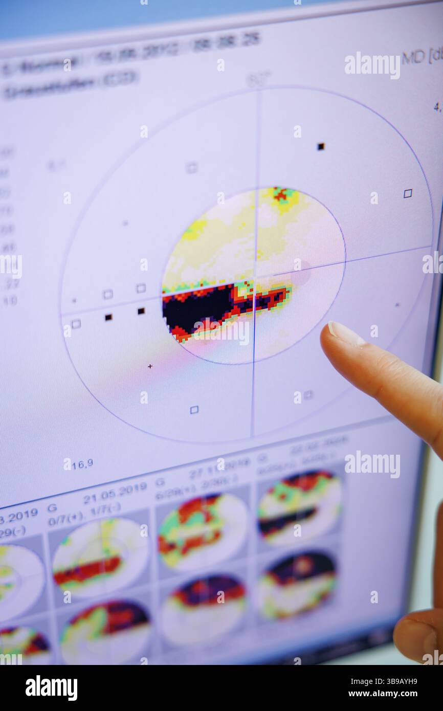 Erlangen, Germany. 23rd May, 2024. A doctor at the eye clinic at ...