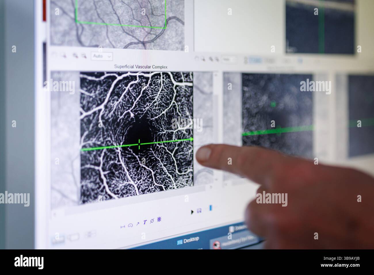 Erlangen, Germany. 23rd May, 2024. An employee of the Eye Clinic at ...