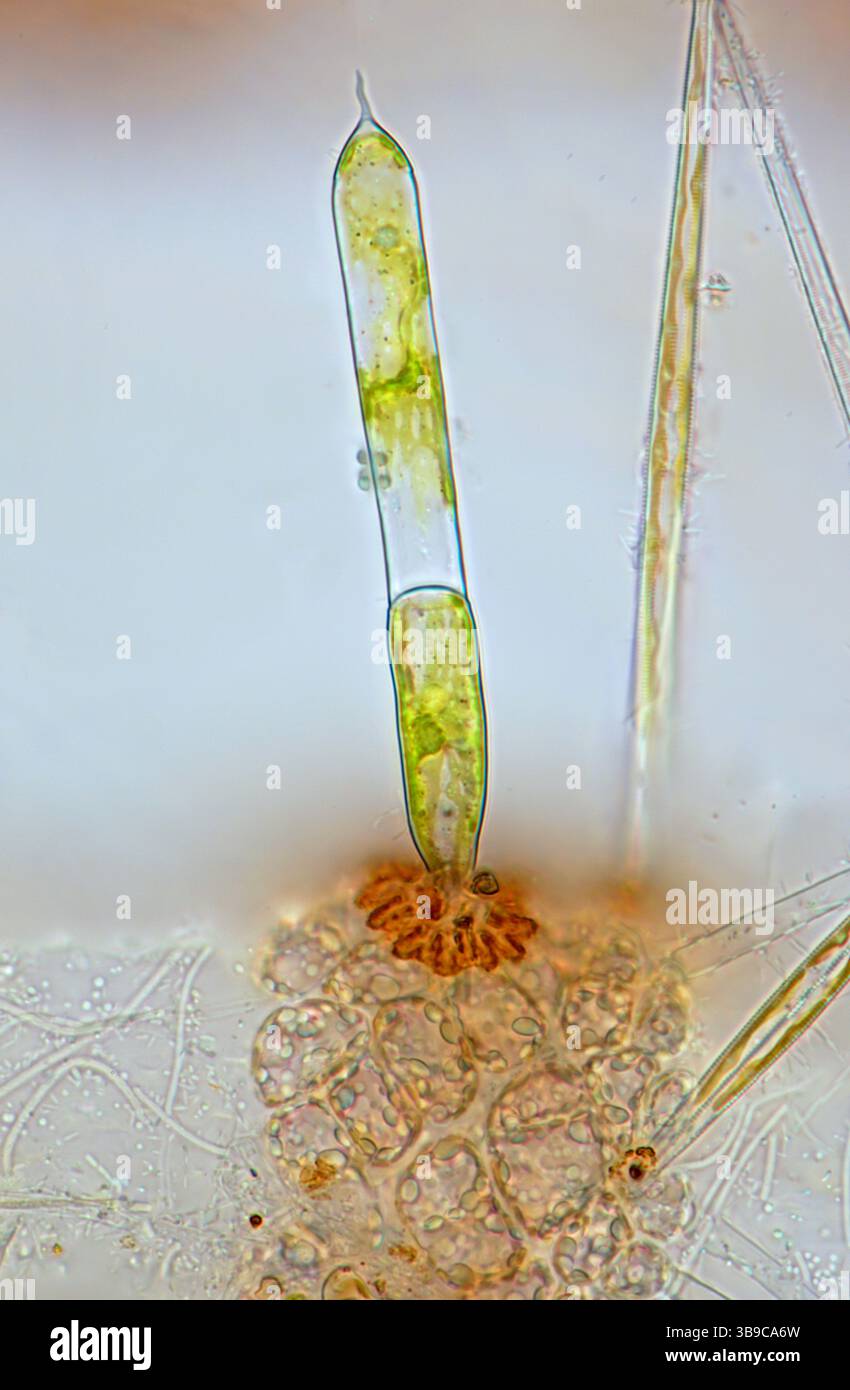 Filamentous green algae attached to red algae, light micrograph Stock ...