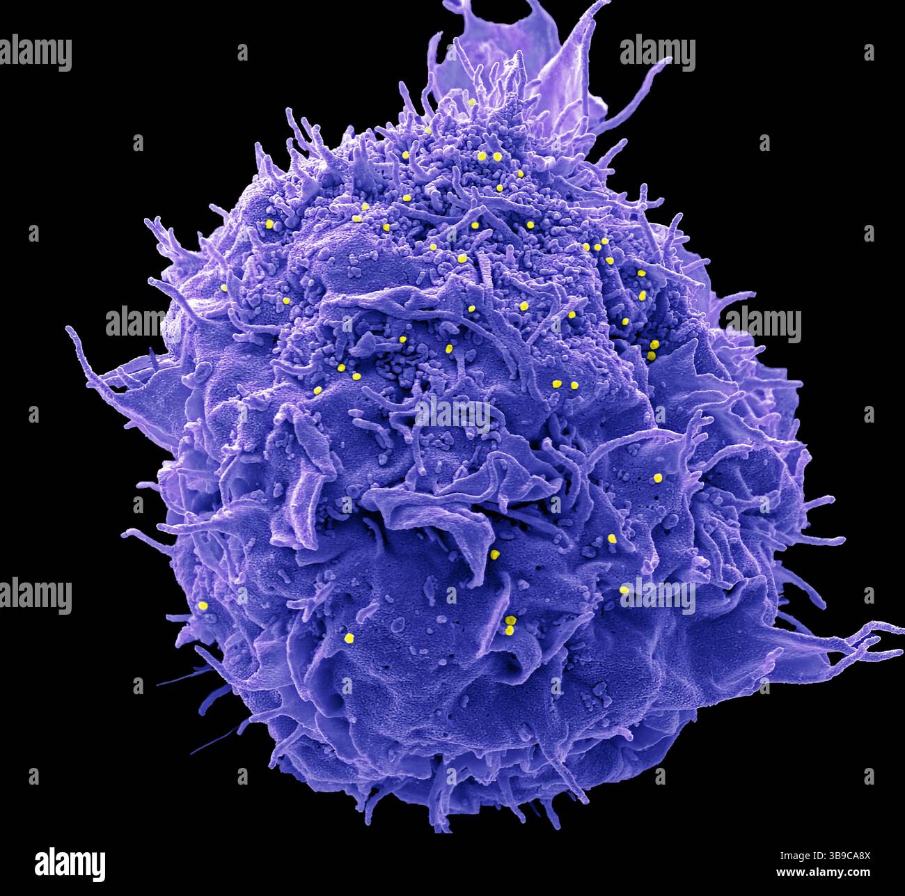 Herpes simplex virus 1, SEM Stock Photo - Alamy