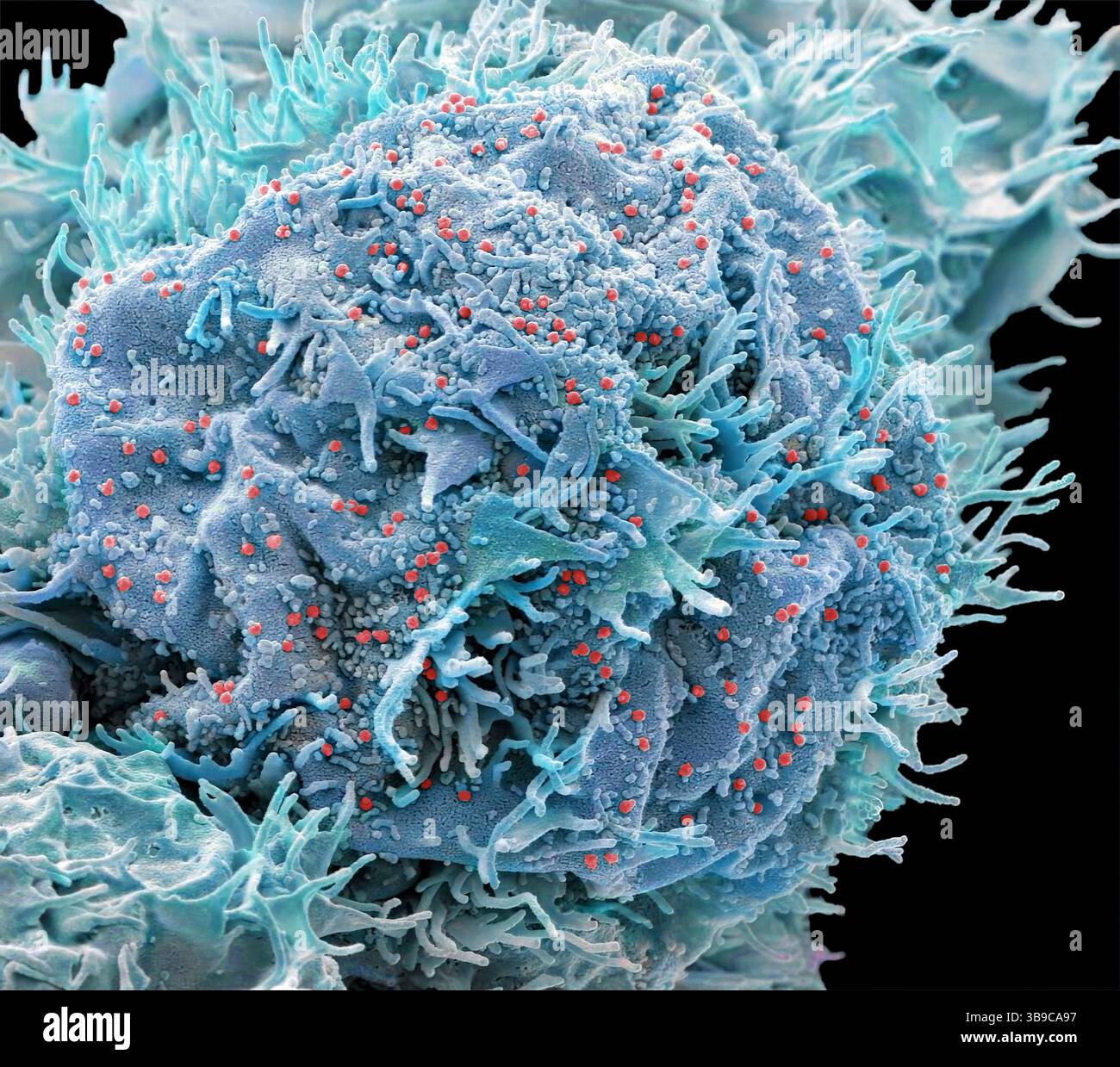 Varicella zoster virus, SEM Stock Photo - Alamy